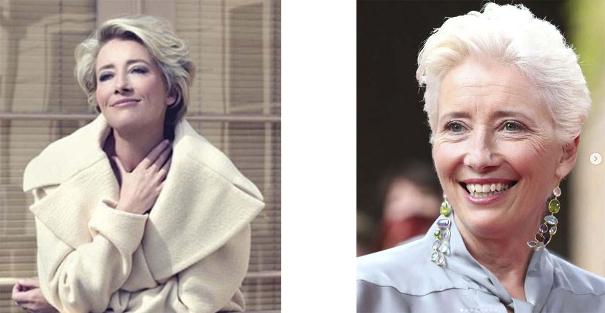 La particular opinión de Emma Thompson sobre las cirugías estéticas ...