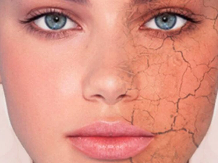¿Cómo se diferencia una piel seca de una deshidratada? - Revista Para Ti