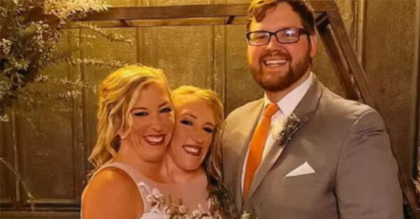 Las fotos de la boda secreta de la gemela siamesa Abby Hensel - Revista ...